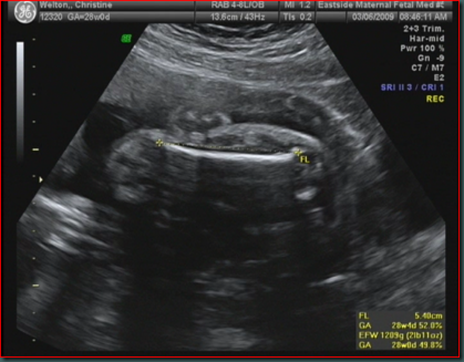 Let It Be: 28 Week Ultrasound